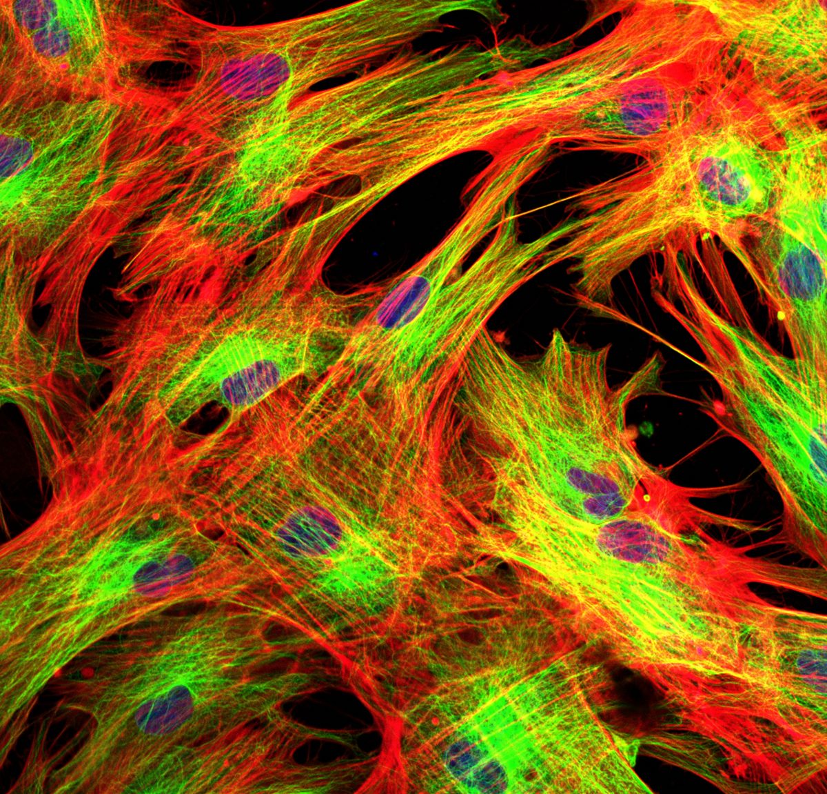 Stanford University Researchers Find Skin Cell Type Associated to Scarring