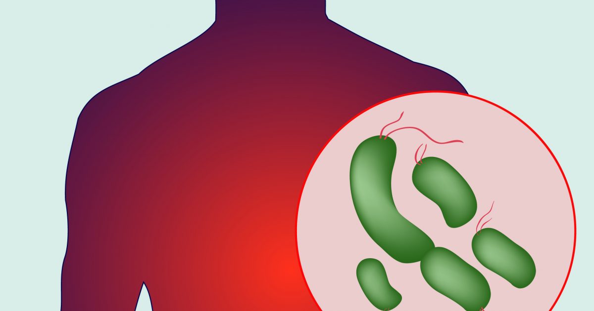 Systemic Sclerosis Patients Intestine Microbiome Enriched by ...