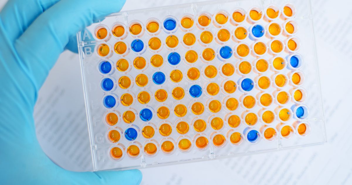 SSc-associated PAH Patients with Anti-U1 RNP Antibodies May Have More ...