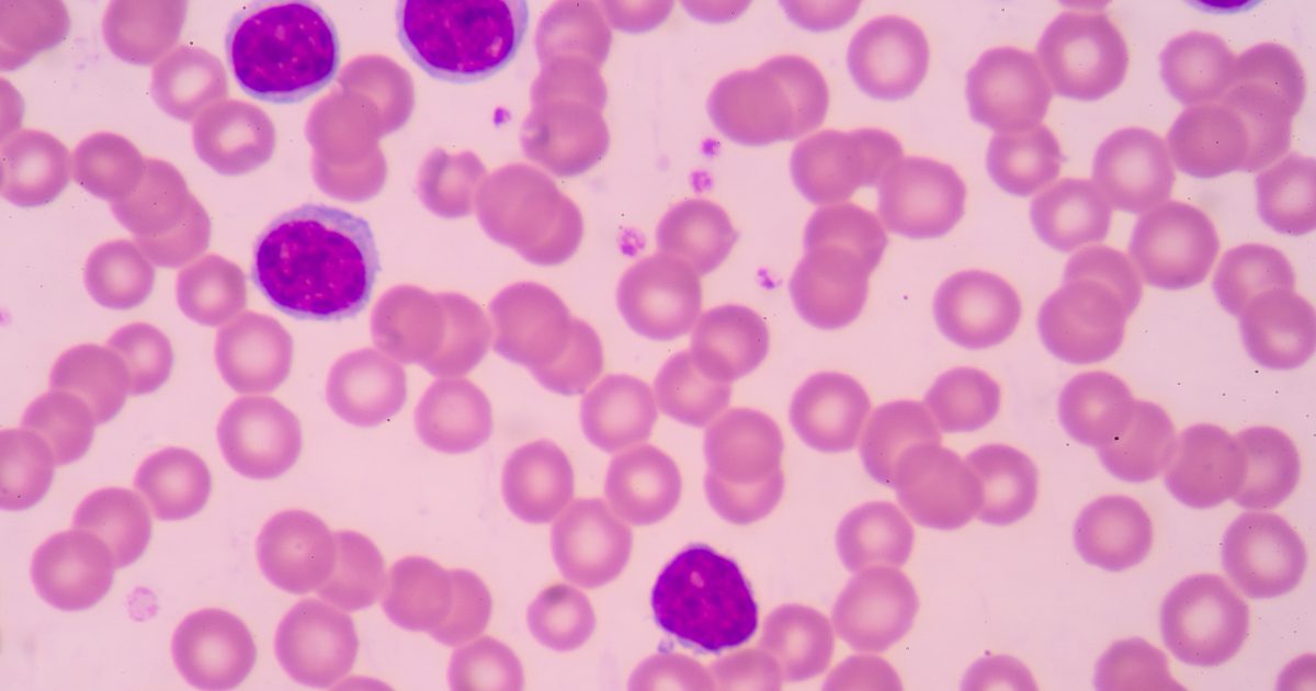 Researchers Show That in Systemic Sclerosis, Innate Lymphoid Cells Play ...