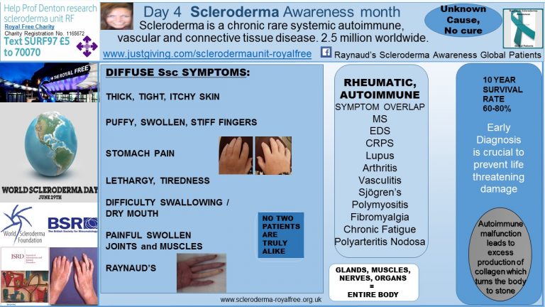 Day 4 SCLERODERMA Awareness Month | Scleroderma News