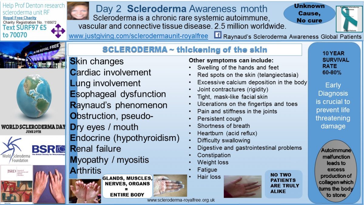 Day 2 SCLERODERMA Awareness Month | Scleroderma News