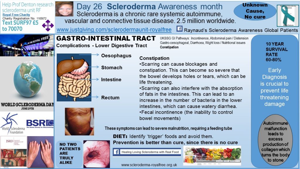 DAY 26 Scleroderma Awareness Month: LOWER GASTRO-INTESTINAL TRACT ...