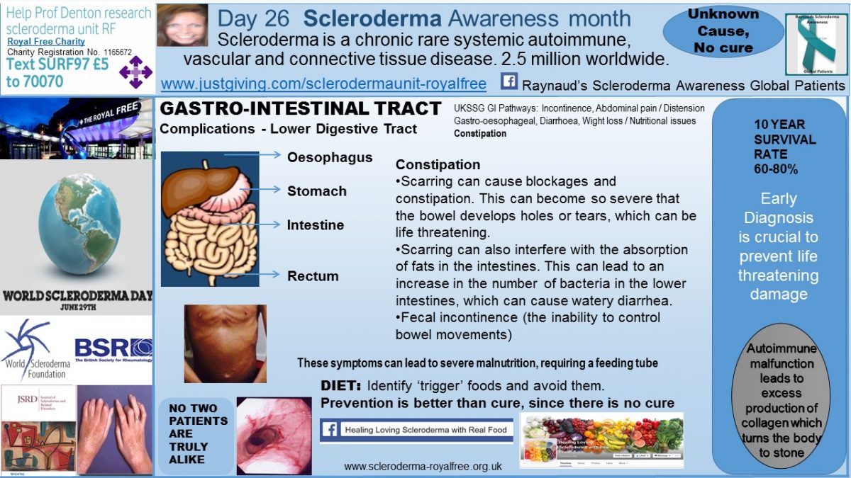DAY 26 Scleroderma Awareness Month: LOWER GASTRO-INTESTINAL TRACT ...