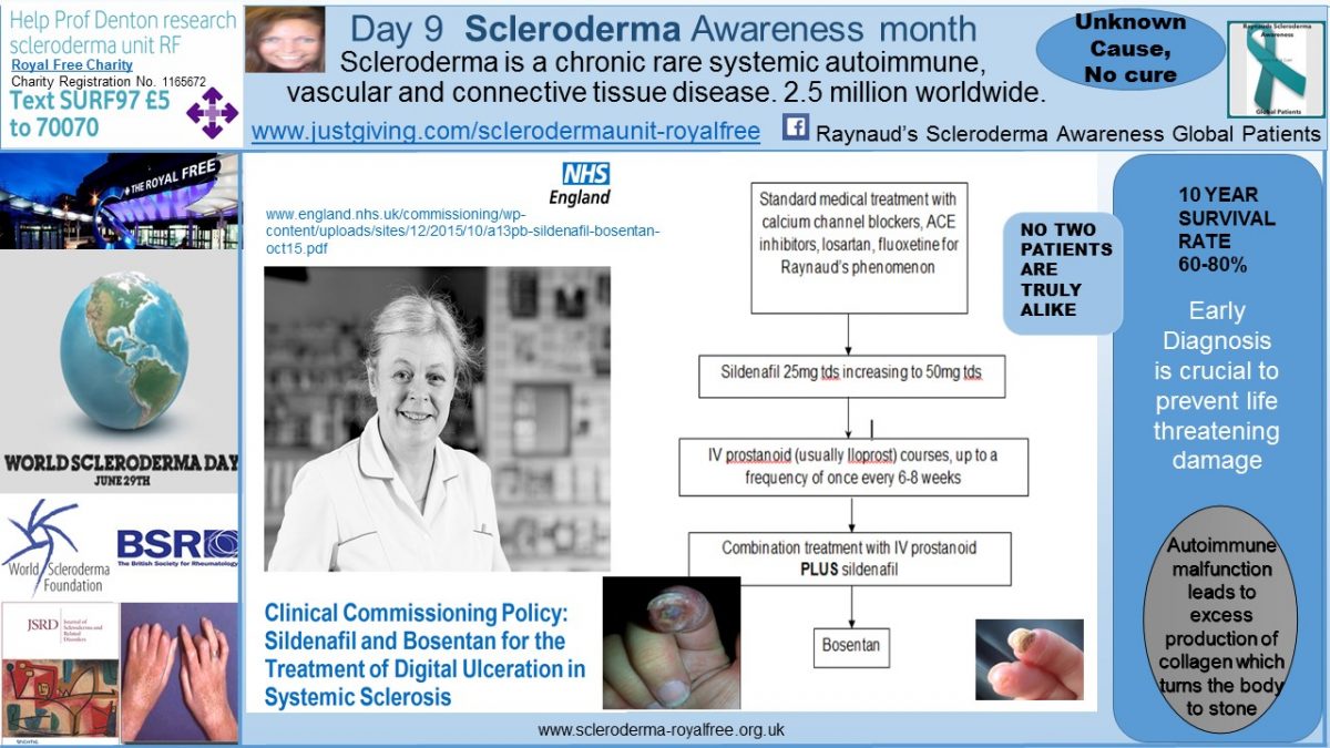 DAY 9 Scleroderma Awareness Month - DIGITAL ULCERS | Scleroderma News