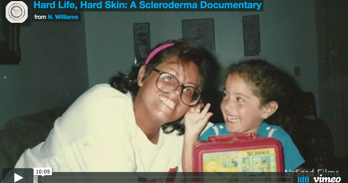 Hard Life, Hard Skin: A Scleroderma Documentary | Scleroderma News
