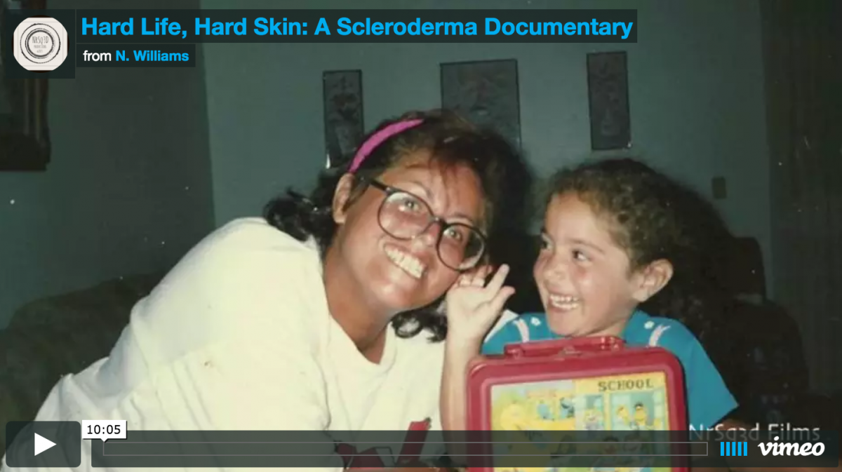 Hard Life, Hard Skin: A Scleroderma Documentary - Scleroderma News
