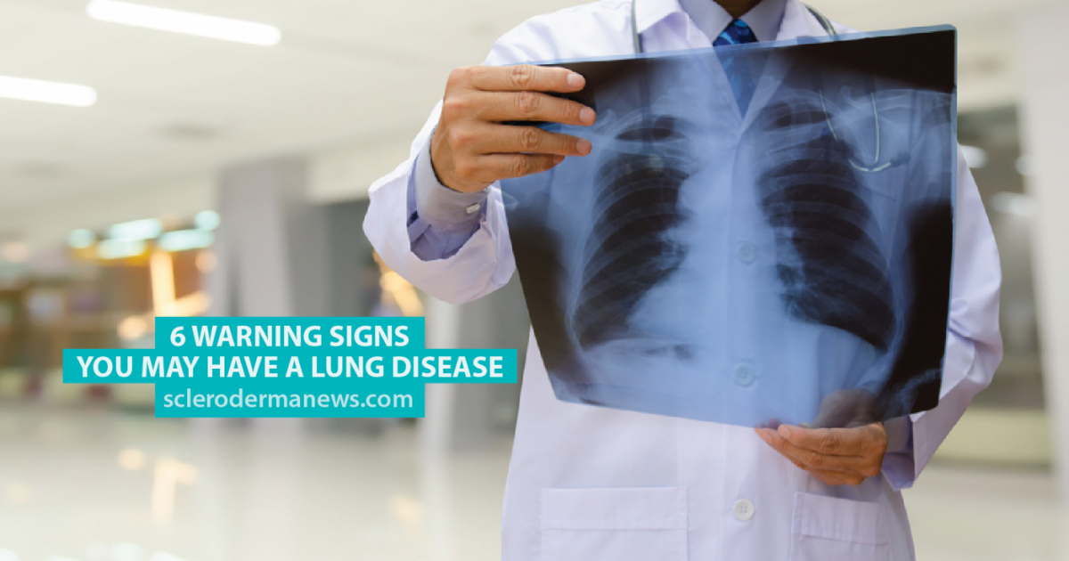 6 Warning Signs You May Have a Lung Disease | Scleroderma News