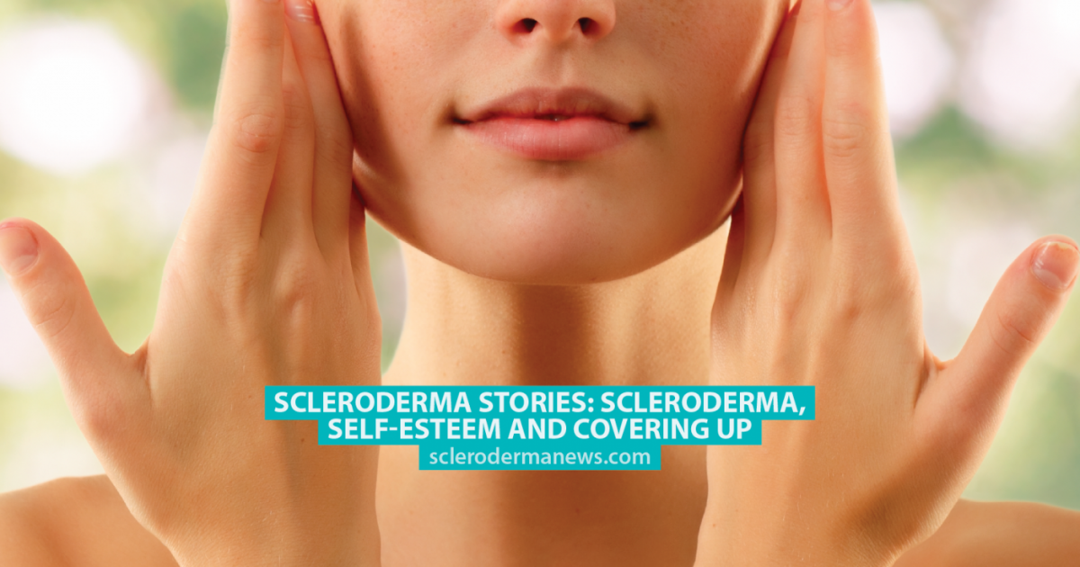 Scleroderma Stories: Scleroderma, Self-Esteem and Covering Up ...