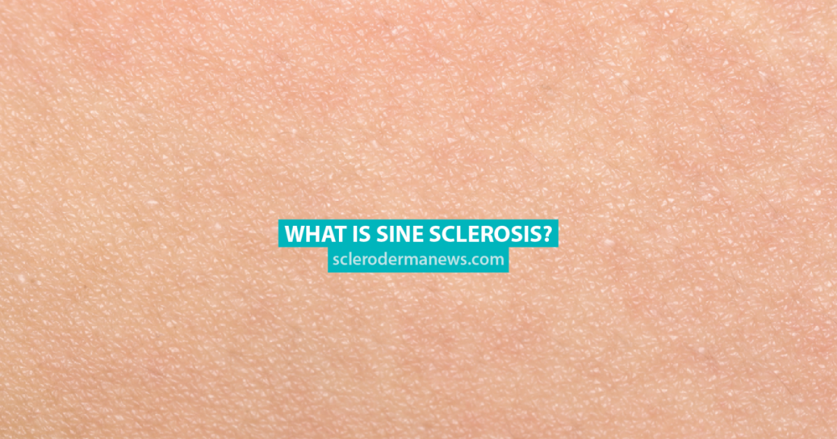 What Is Sine Sclerosis? | Scleroderma News