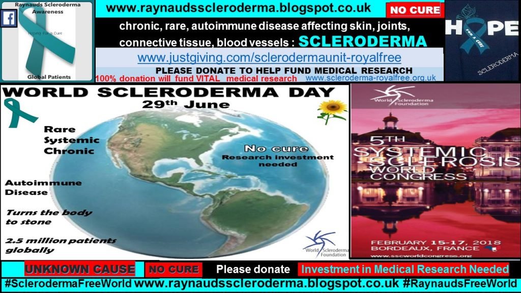 June 29 Is World Scleroderma Day 2017: Here's Why It's Important