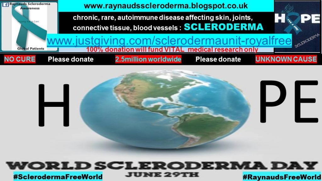 June 29 Is World Scleroderma Day 2017: Here's Why It's Important