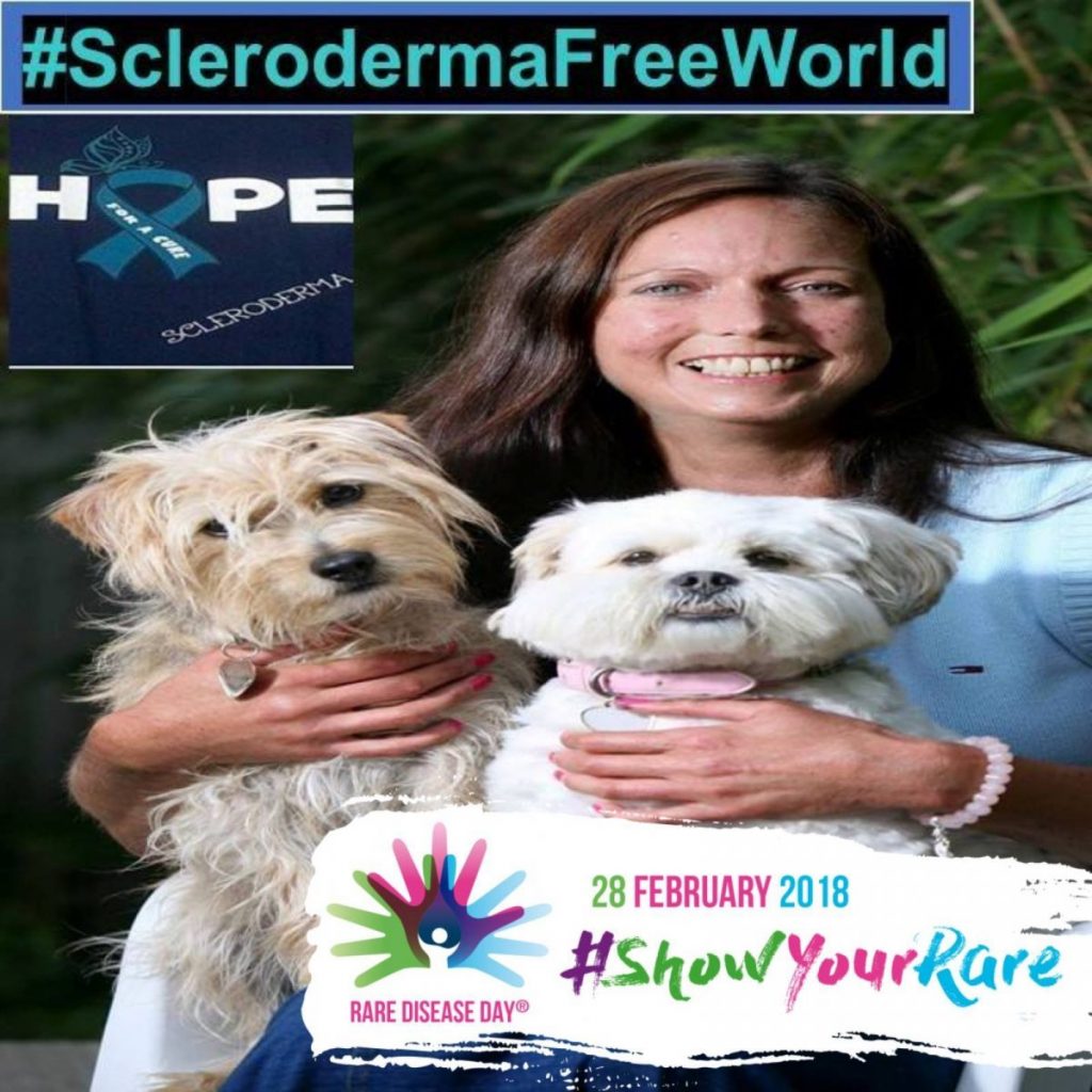 Scleroderma: March Is Autoimmune Disease Awareness Month